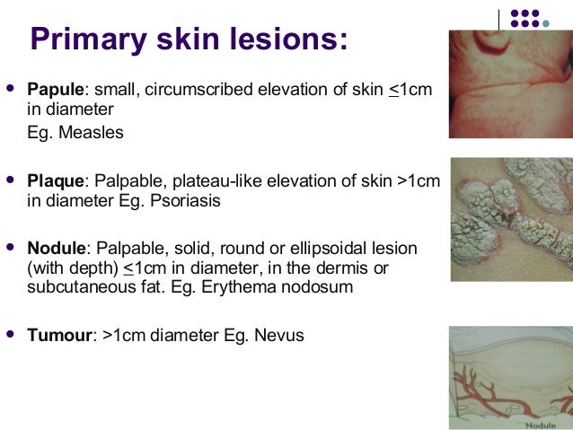 Approach to a_child_with_rash[1]