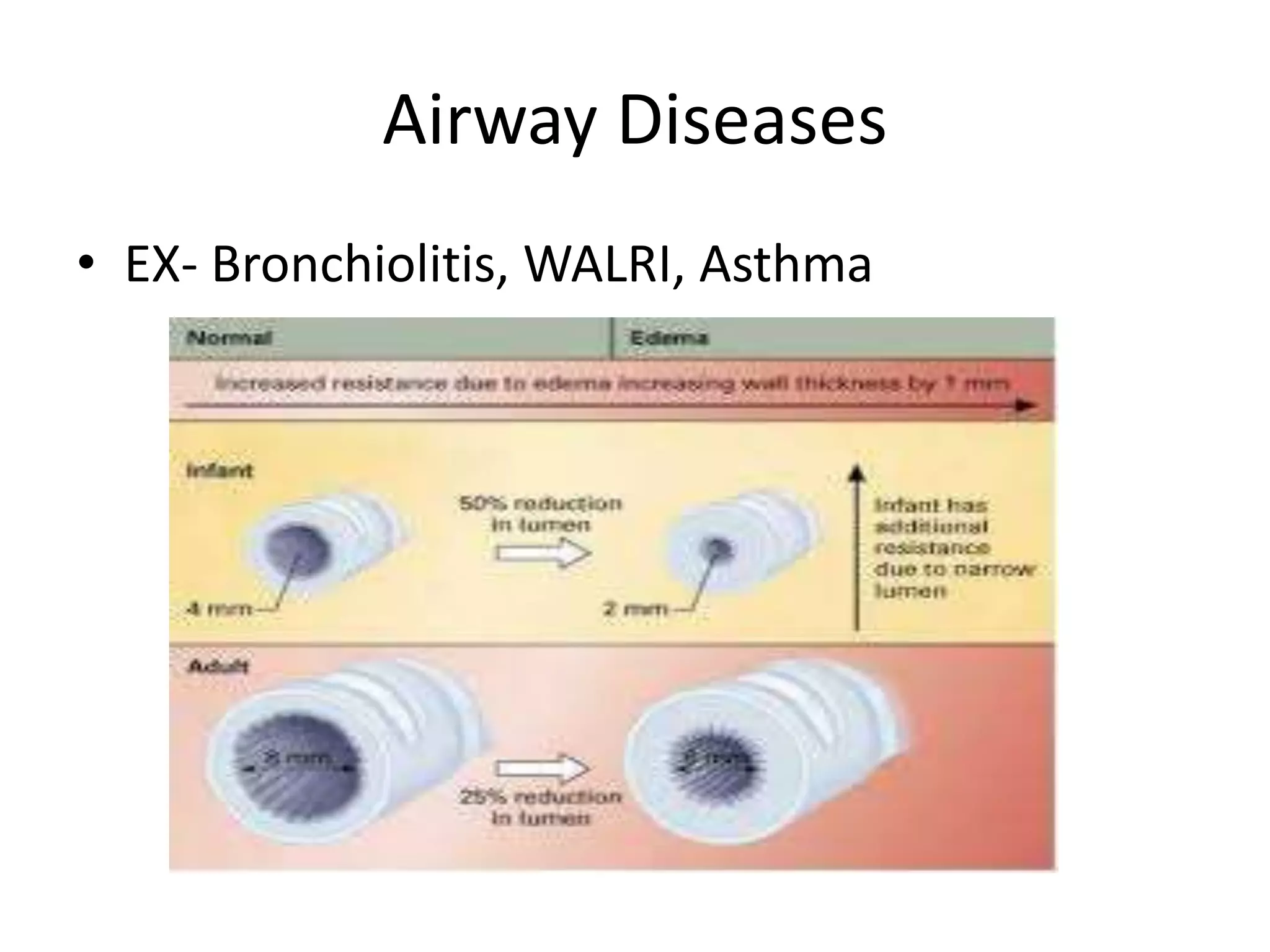 Approach to a child with respiratory distress | PPTX