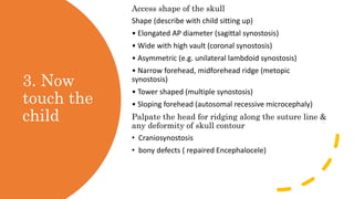 Approach to a child with small head | PPTX