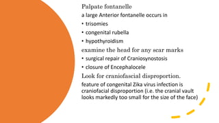 Approach to a child with small head | PPTX