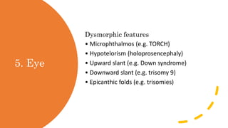 Approach to a child with small head | PPTX