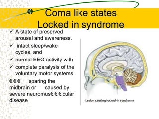 Approach to a comatose child | PPTX