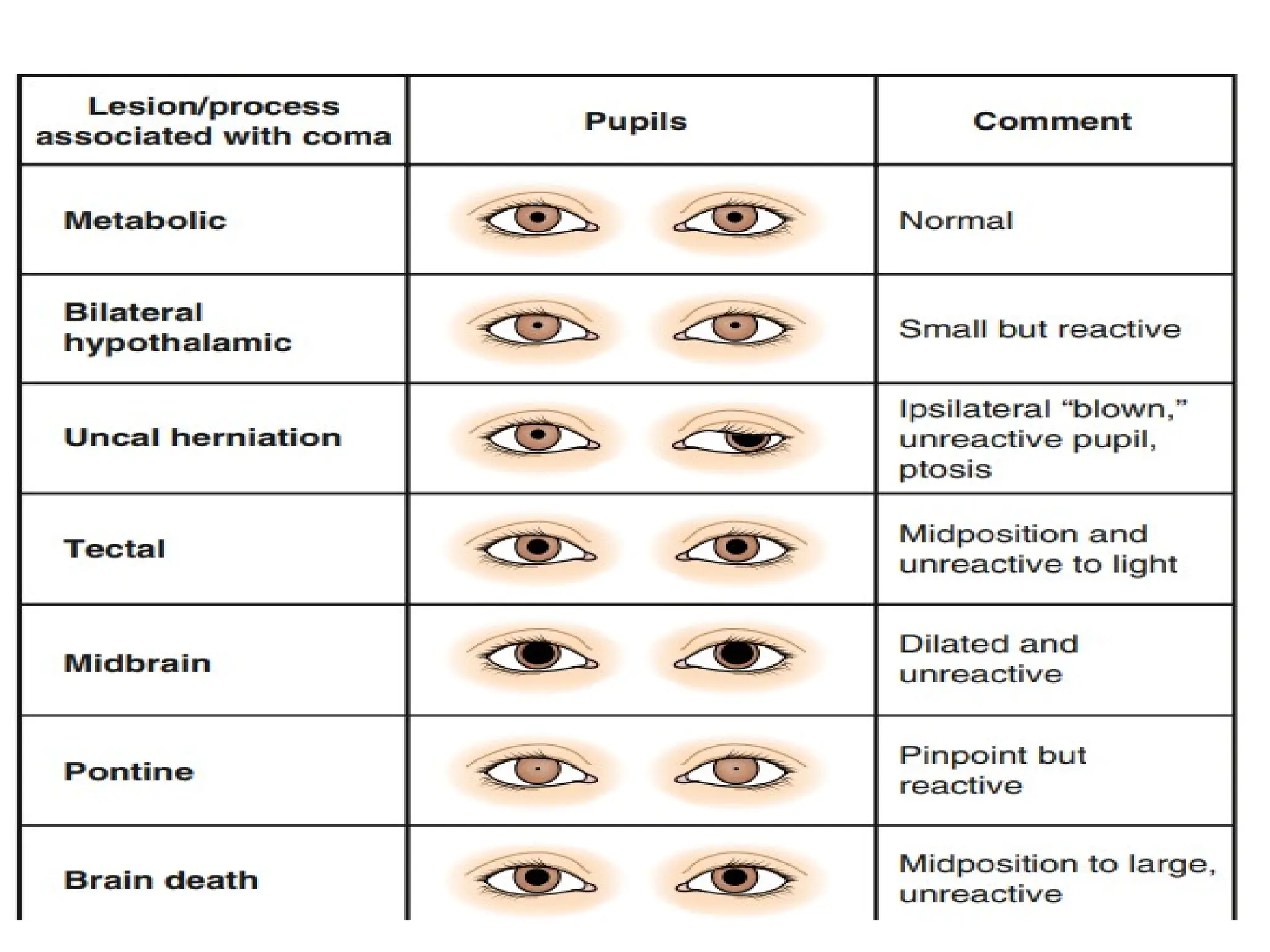 Approach_ to_ a comatos patient........pptx