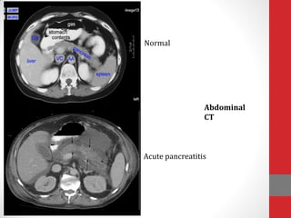 Approach to acute abdomen presntation slides.pdf
