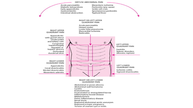 Approach to acute abdominal pain..new4.pptx