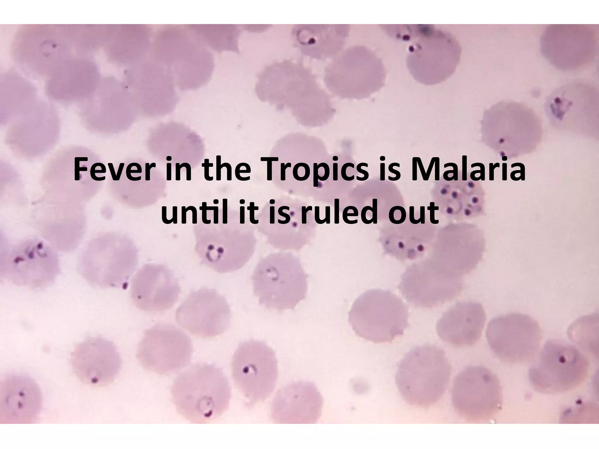 Approach to acute febrile illness | PDF