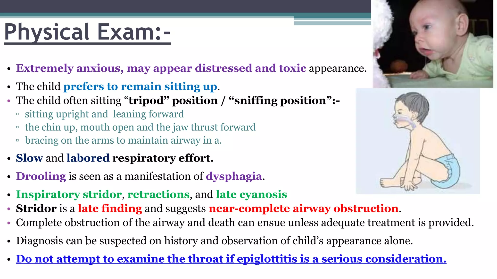 Approach to Acute infective upper airway obstruction (infective stridor ...
