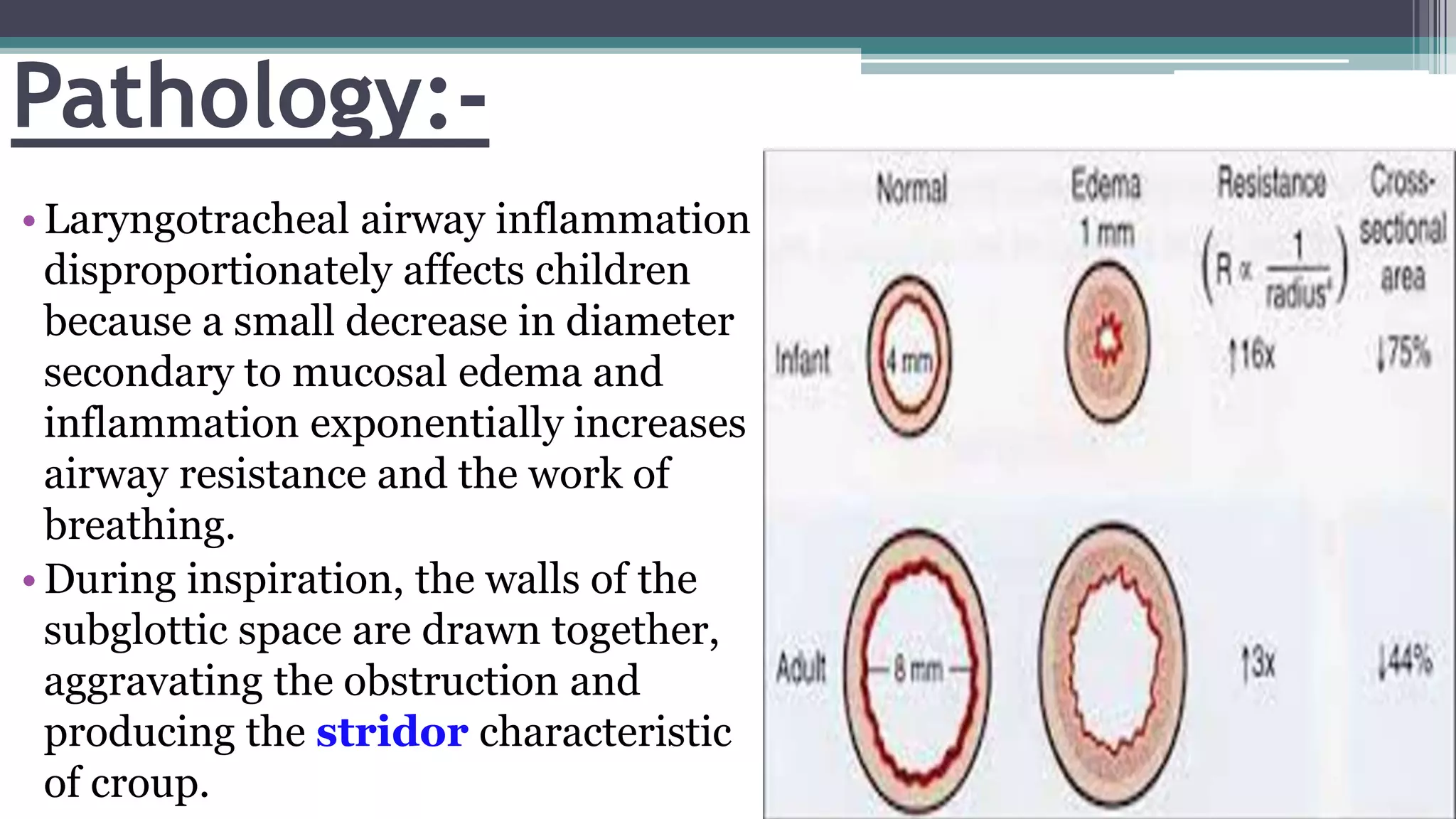 Approach to Acute infective upper airway obstruction (infective stridor ...