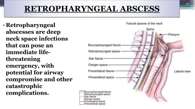 Approach to Acute infective upper airway obstruction (infective stridor ...