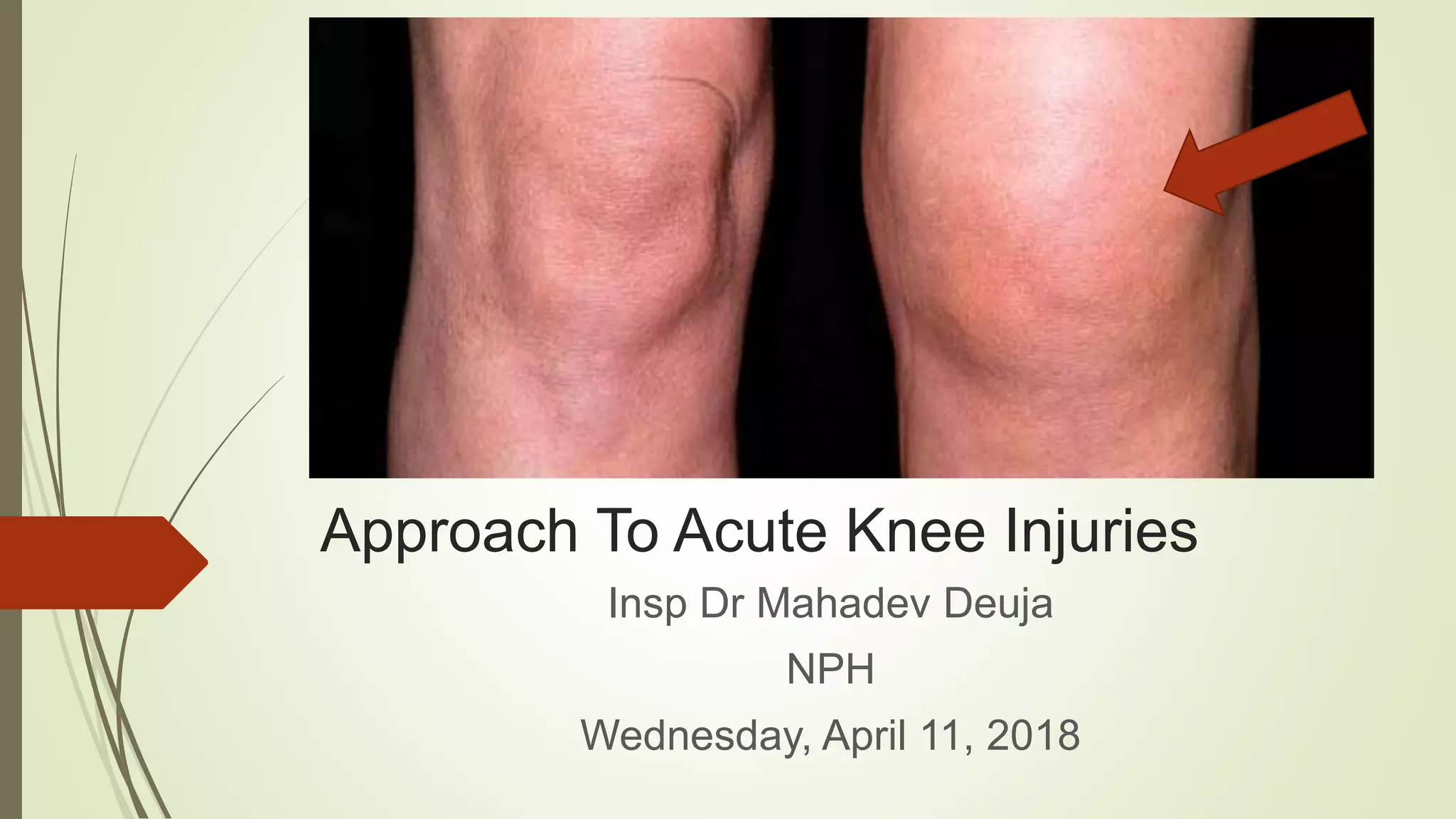 Approach to acute knee injuries (knee injury) | PPTX