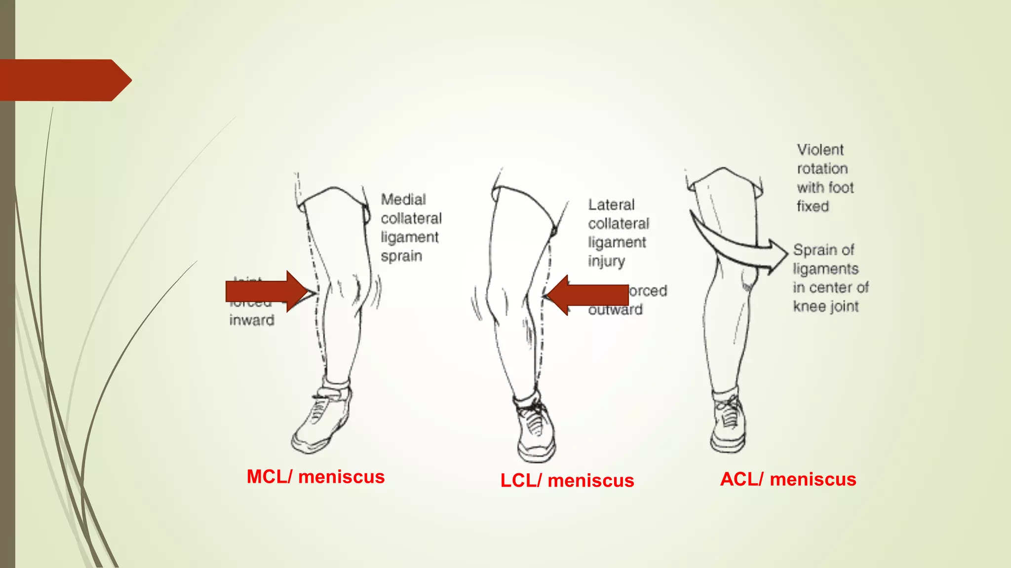 Approach to acute knee injuries (knee injury) | PPTX