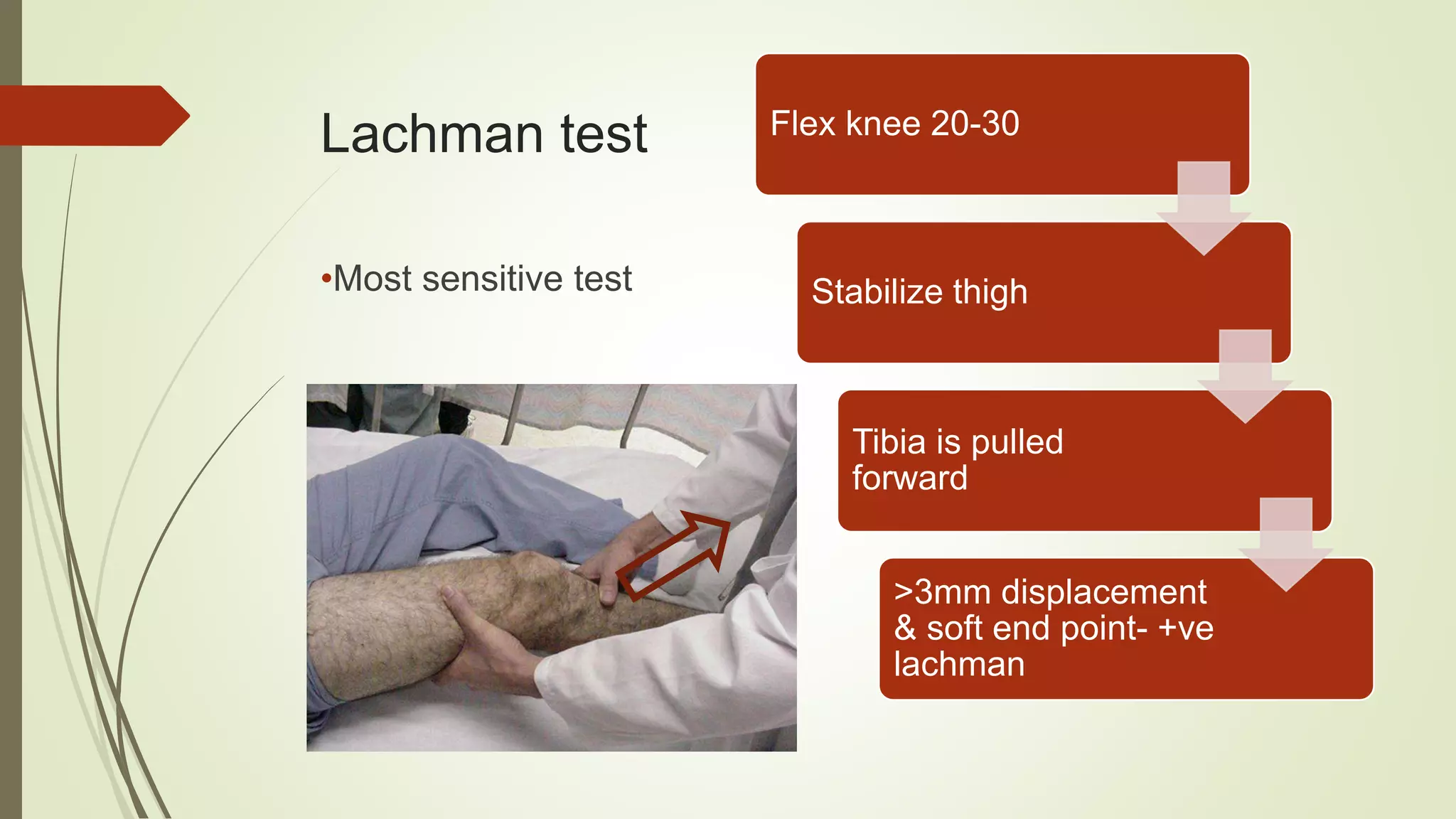 Approach to acute knee injuries (knee injury) | PPTX