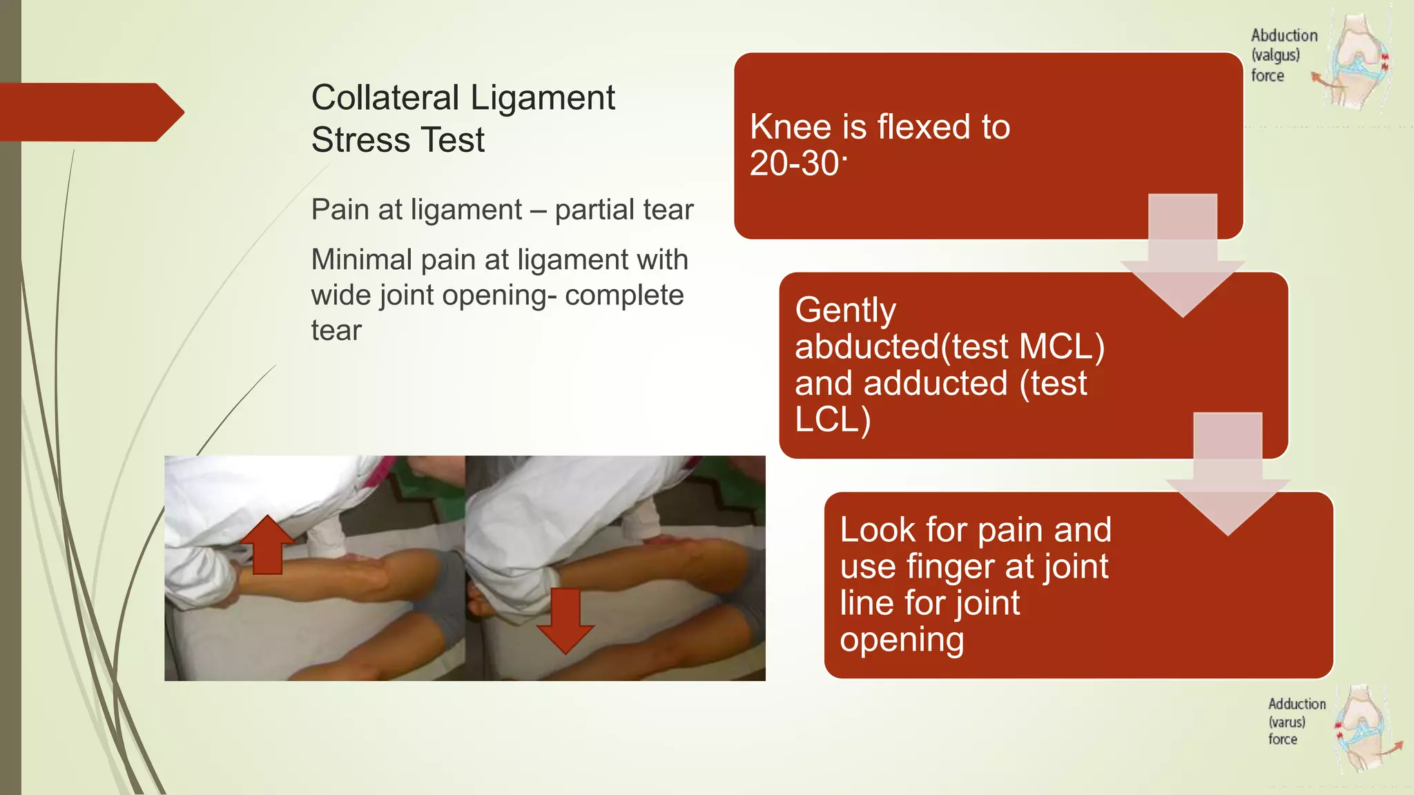 Approach to acute knee injuries (knee injury) | PPTX