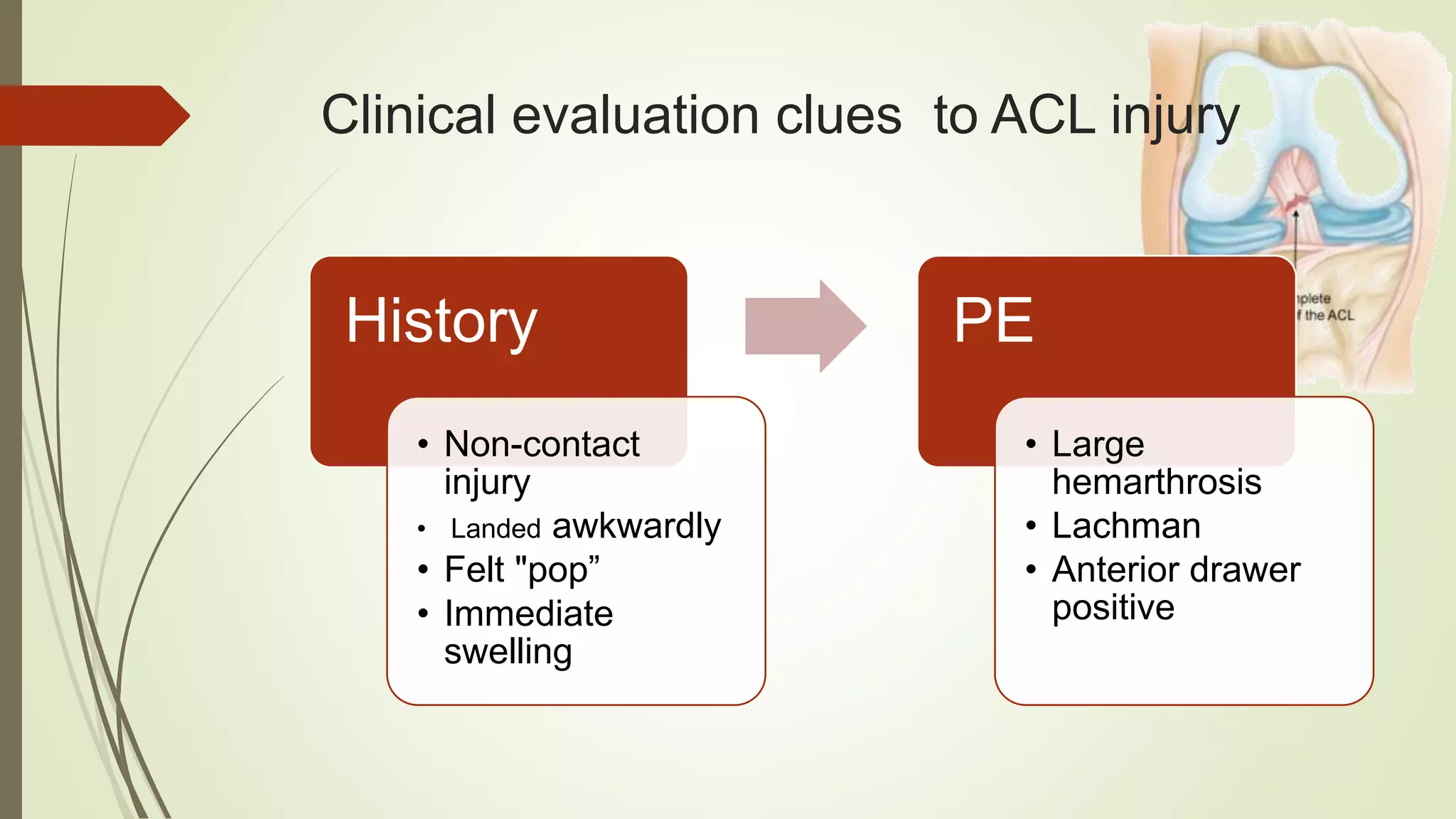 Approach to acute knee injuries (knee injury) | PPTX