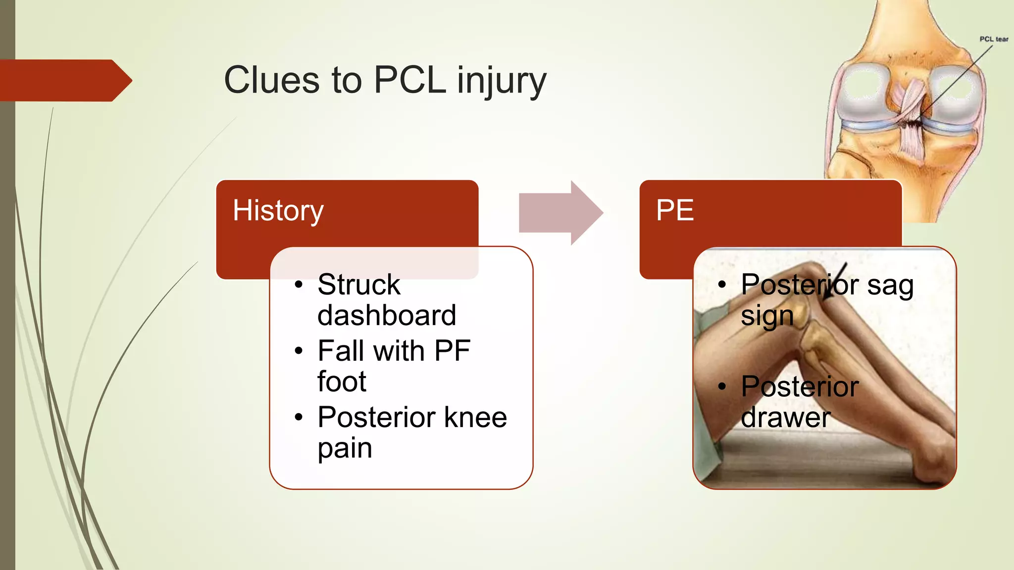 Approach to acute knee injuries (knee injury) | PPTX