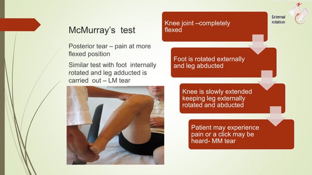 Approach to acute knee injuries (knee injury) | PPTX | Death, Injury ...