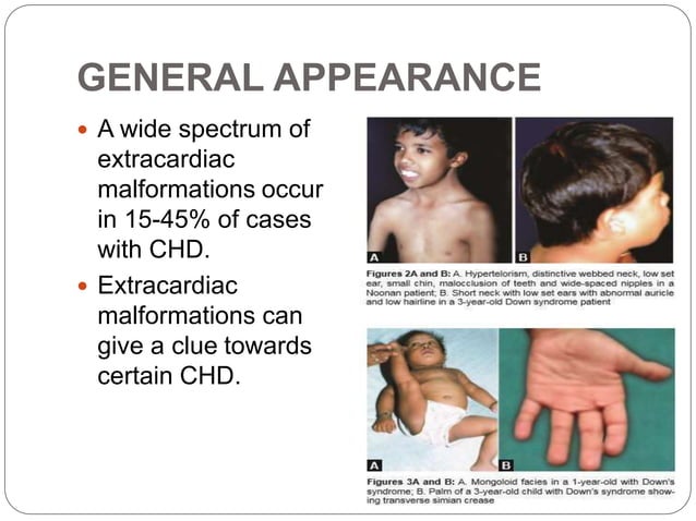 approachtoacyanoticcongenitalheartdiseasesbynag-160721044129.pptx