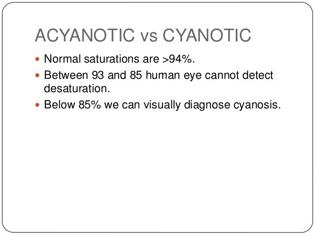 Approach to acyanotic congenital heart diseases