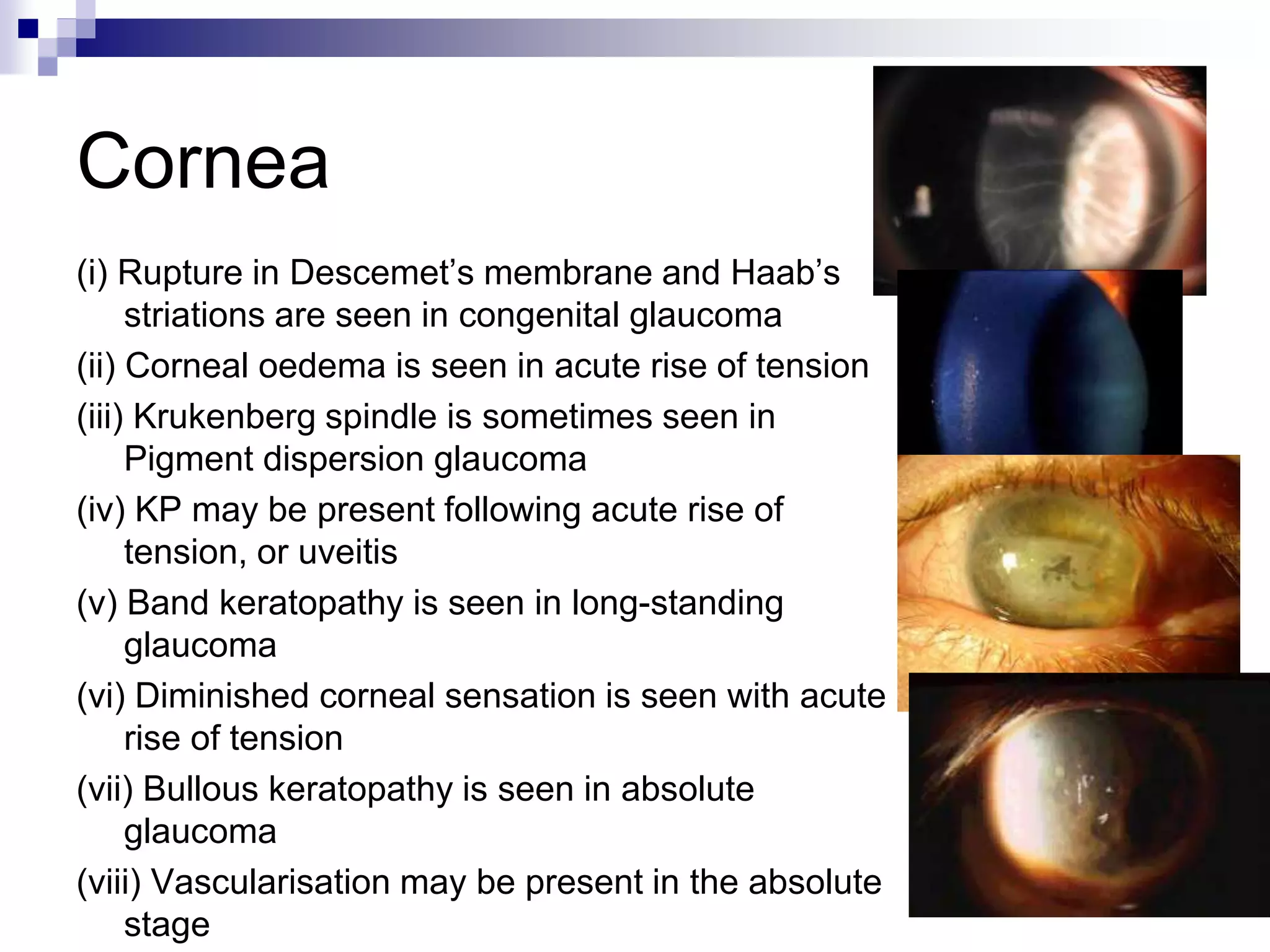 Approach to a glaucoma | PPTX