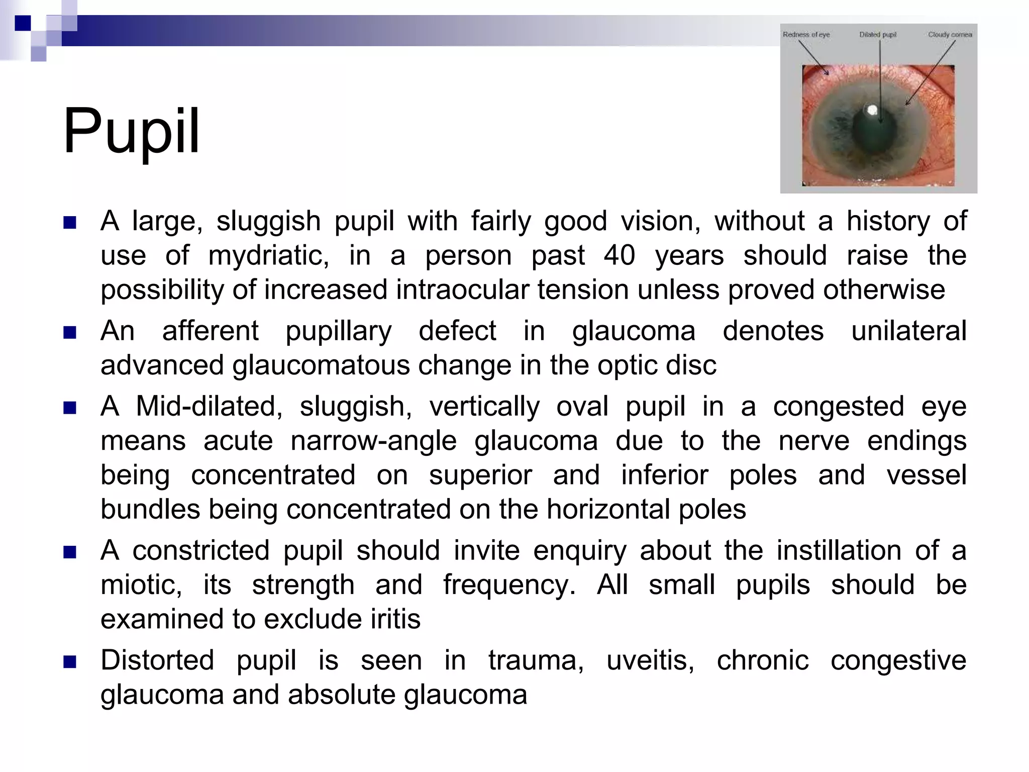Approach to a glaucoma | PPTX