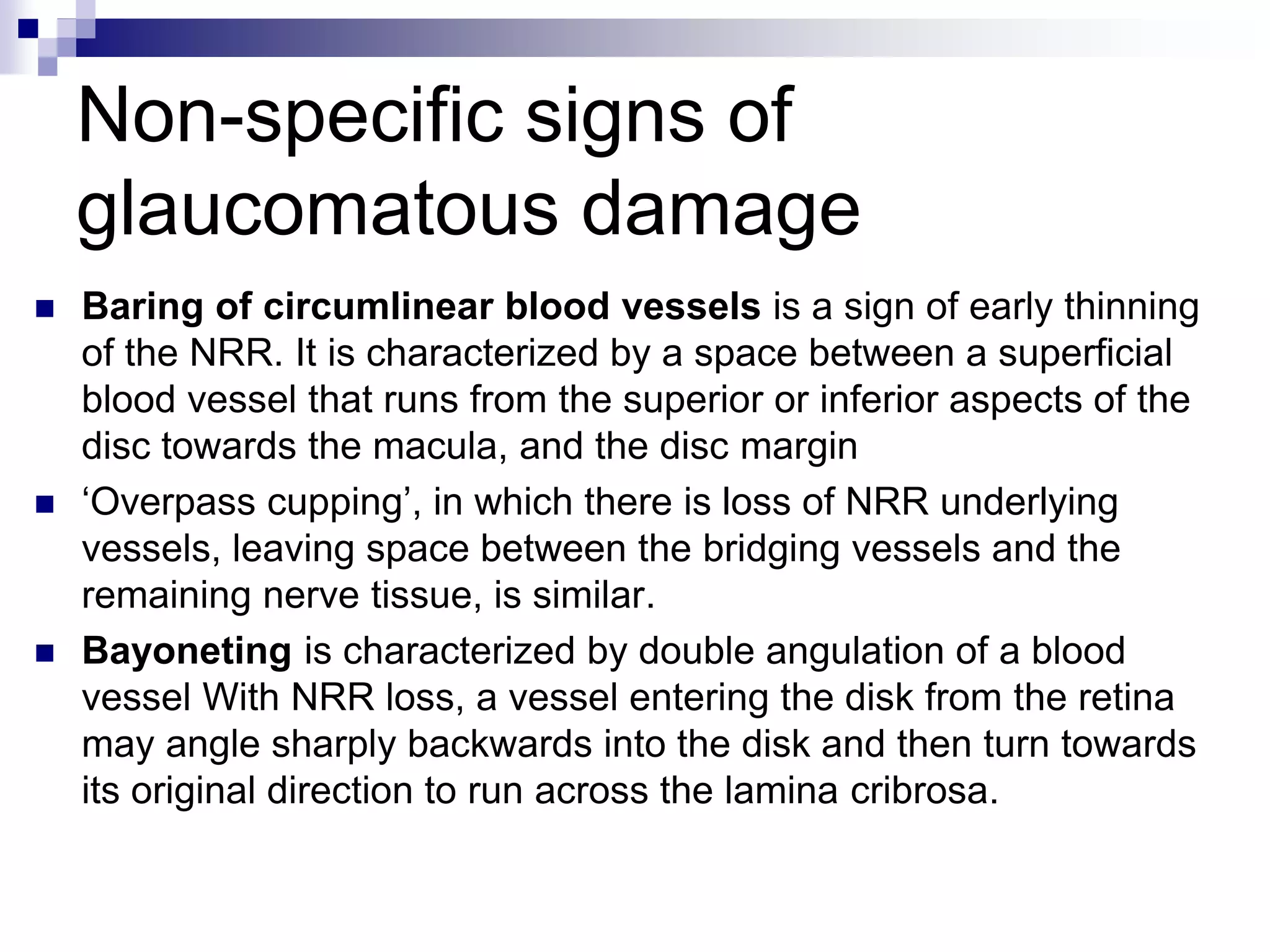 Approach to a glaucoma | PPTX