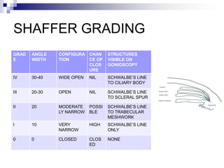 Approach to a glaucoma | PPT