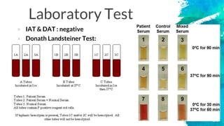 Approach to Autoimmune Hemolytic Anemia | PPTX