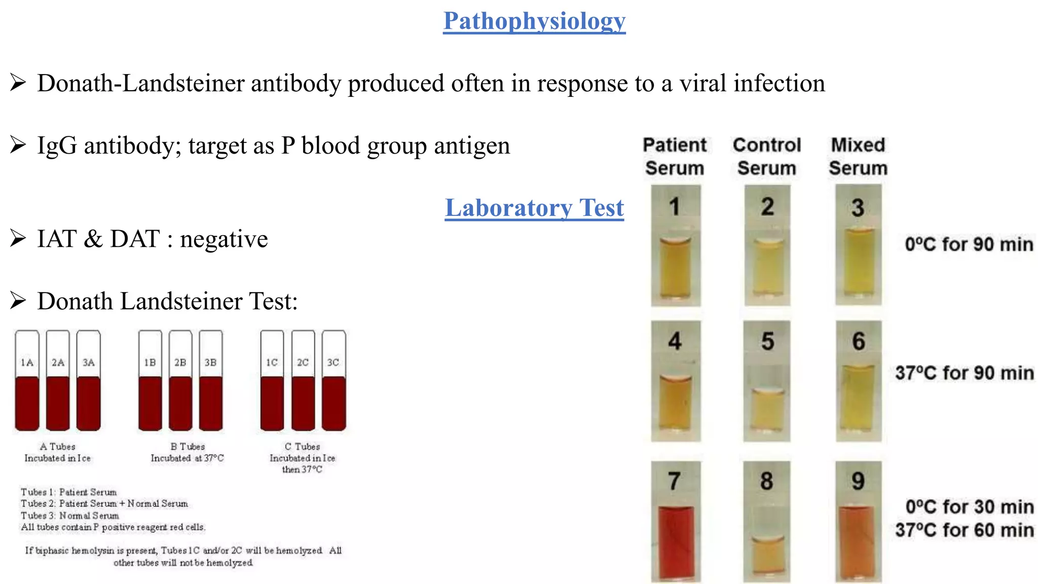 Approach to Autoimmune hemolytic anemia | PPT
