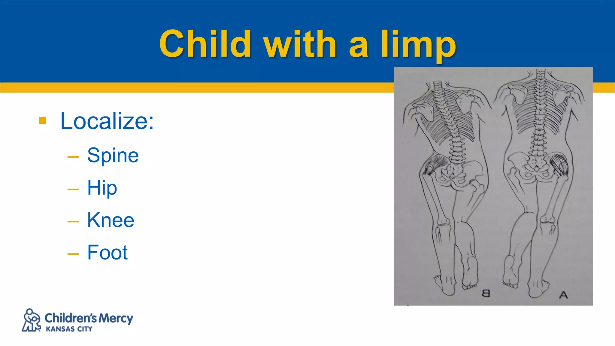 Approach to a limping child.pdf