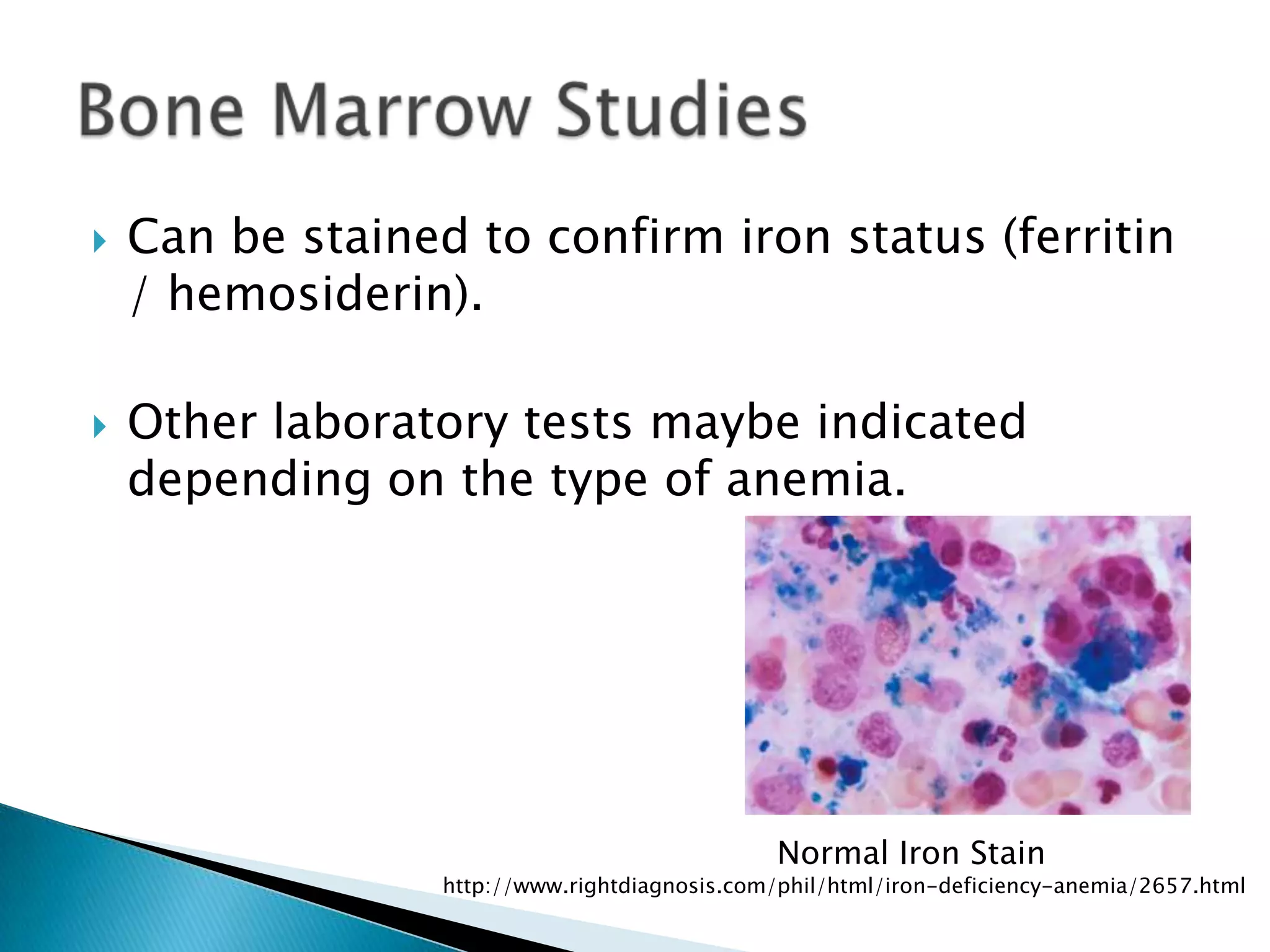 Approach to Anemia | PPTX