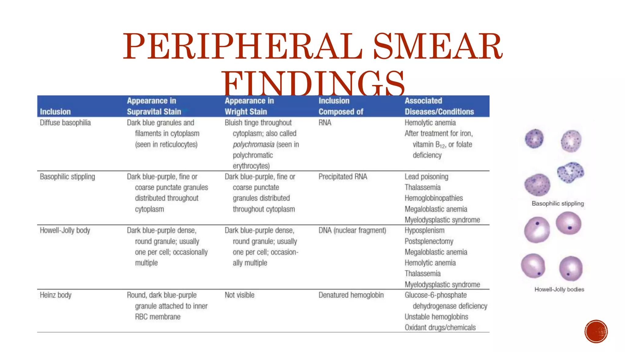 Approach to anemia | PPTX