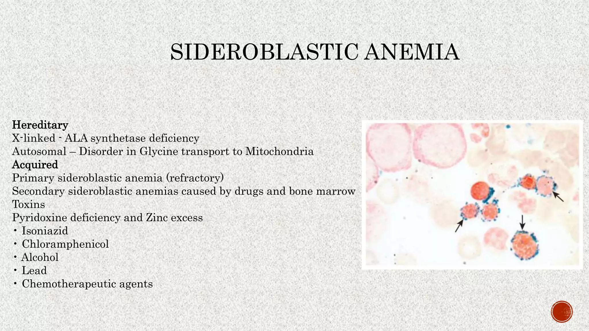Approach to anemia | PPTX
