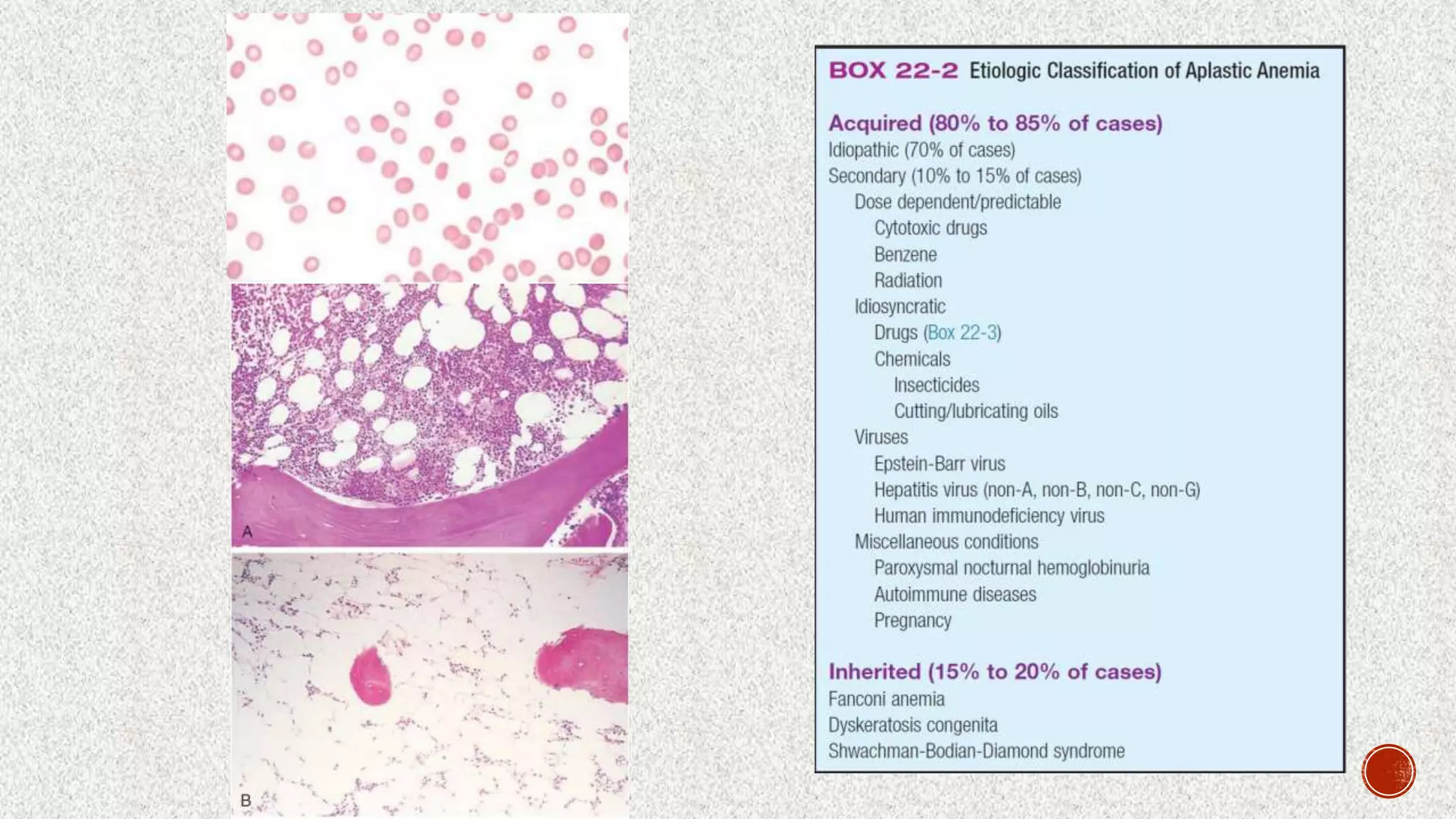 Approach to anemia | PPTX