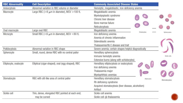 Approach to anemia | PPTX