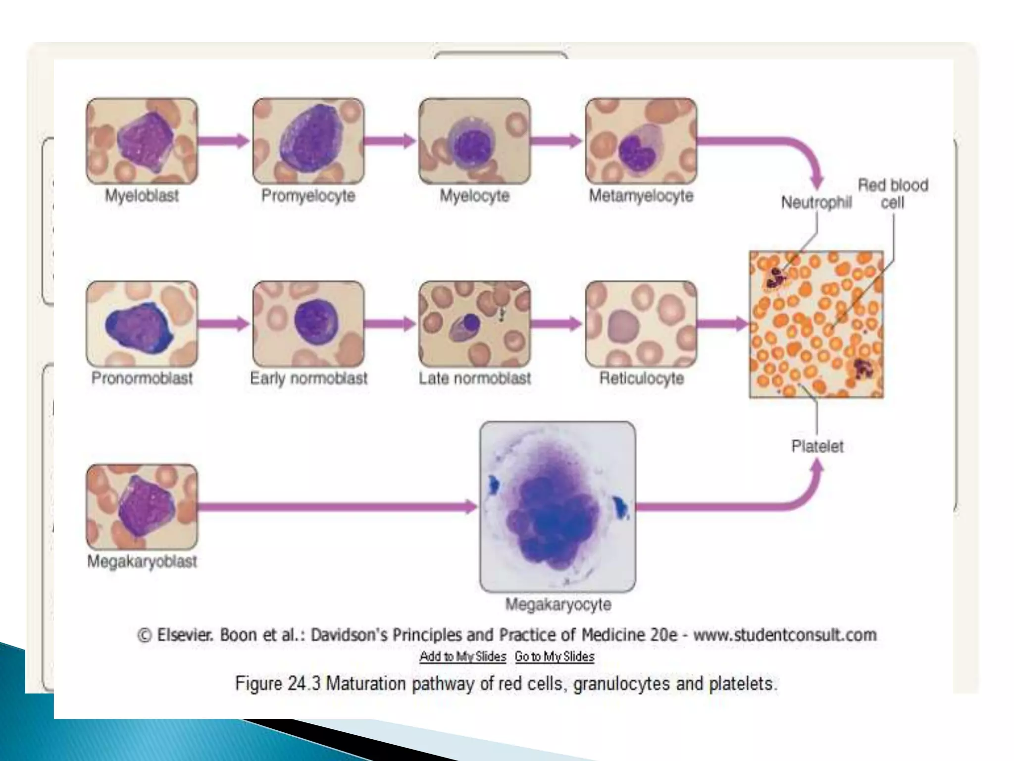 Approach to anemia | PPT