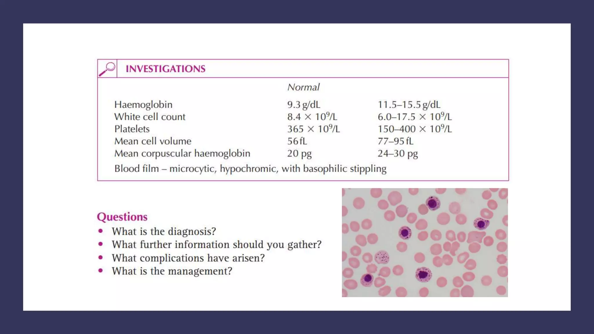 Approach to Pediatric Anemia | PPTX