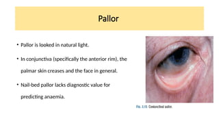 Approach to anemia based on Harrison's book | PPTX