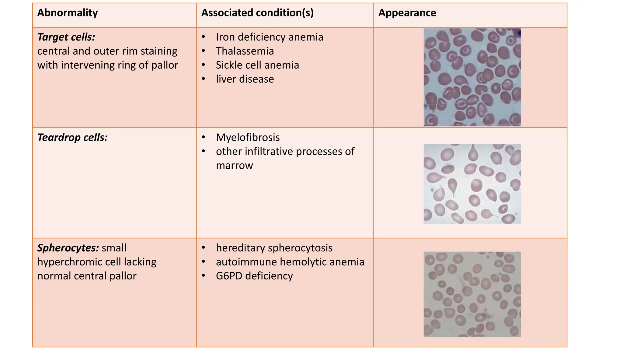 Approach to Anemia - Copy.pptx how to diagnose | PPT