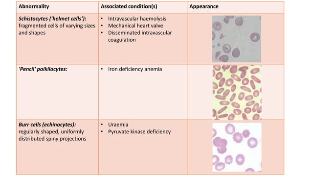 Approach to Anemia - Copy.pptx how to diagnose | PPT