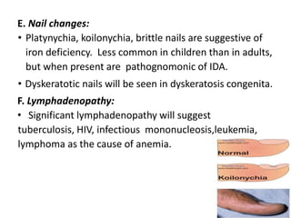 Approach to anemia in children | PPTX