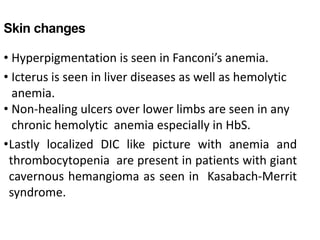 Approach to anemia in children | PPTX