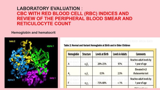 approach to anemia in children: IDA , MEGALOBLASTIC ANEMIA AND APLASTIC ...