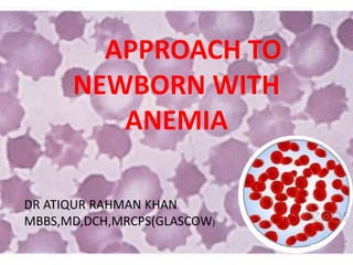 Approach to a neonate | PPTX