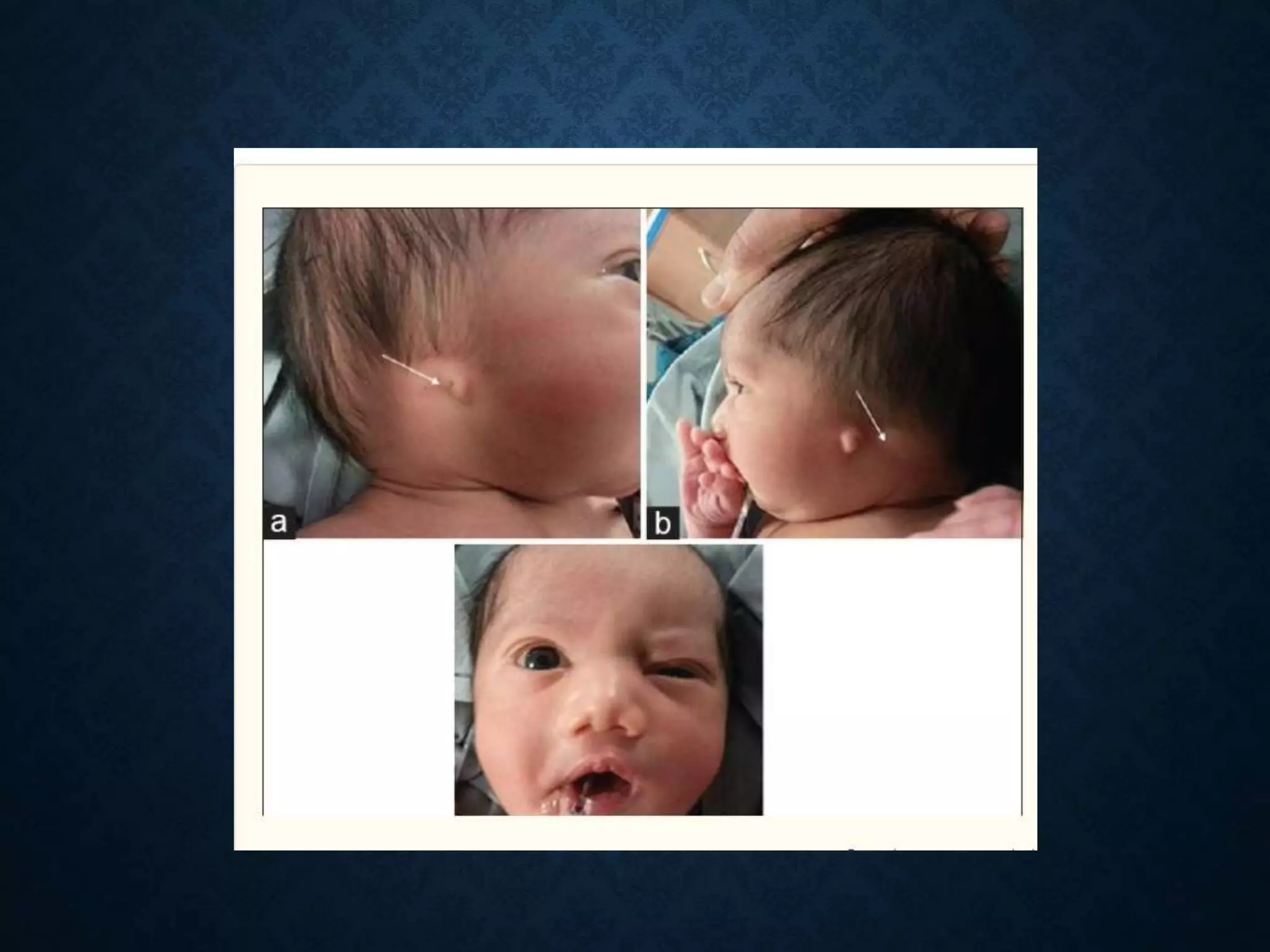 Approach to a newborn with multiple congenital anomaly | PPTX