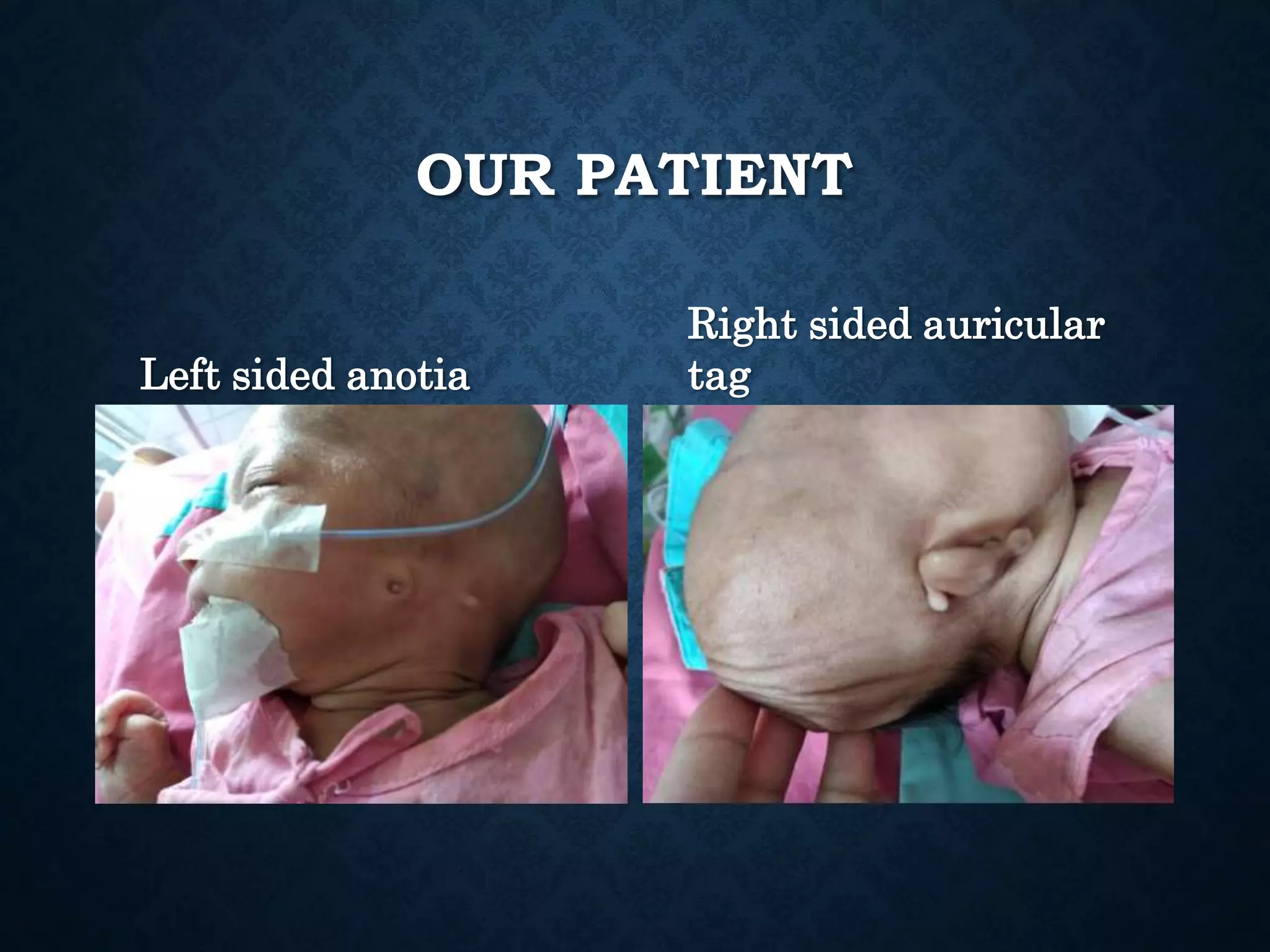 Approach to a newborn with multiple congenital anomaly | PPTX