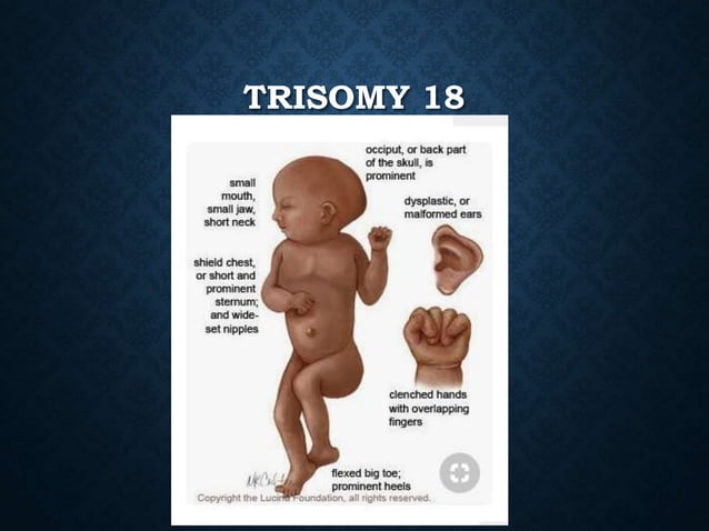 Approach to a newborn with multiple congenital anomaly | PPTX | Pregnancy | Reproductive Health