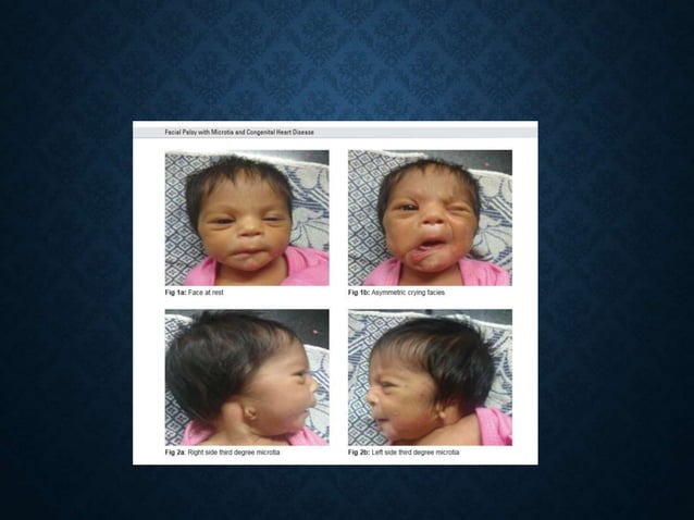 Approach to a newborn with multiple congenital anomaly | PPTX | Pregnancy | Reproductive Health