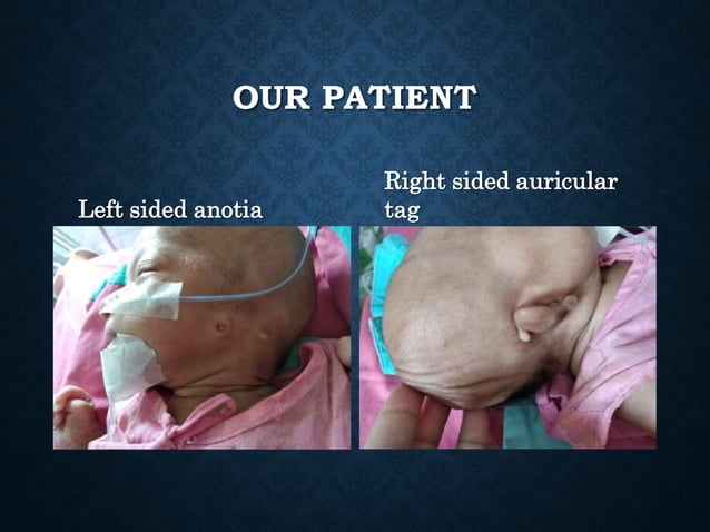 Approach to a newborn with multiple congenital anomaly | PPTX ...