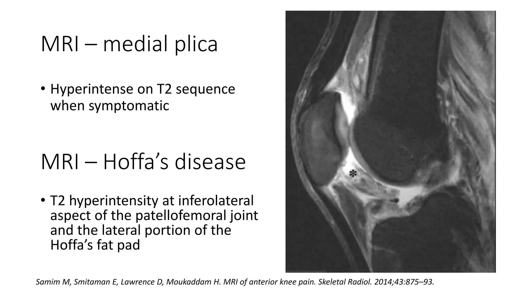 Approach to anterior knee pain.pptx