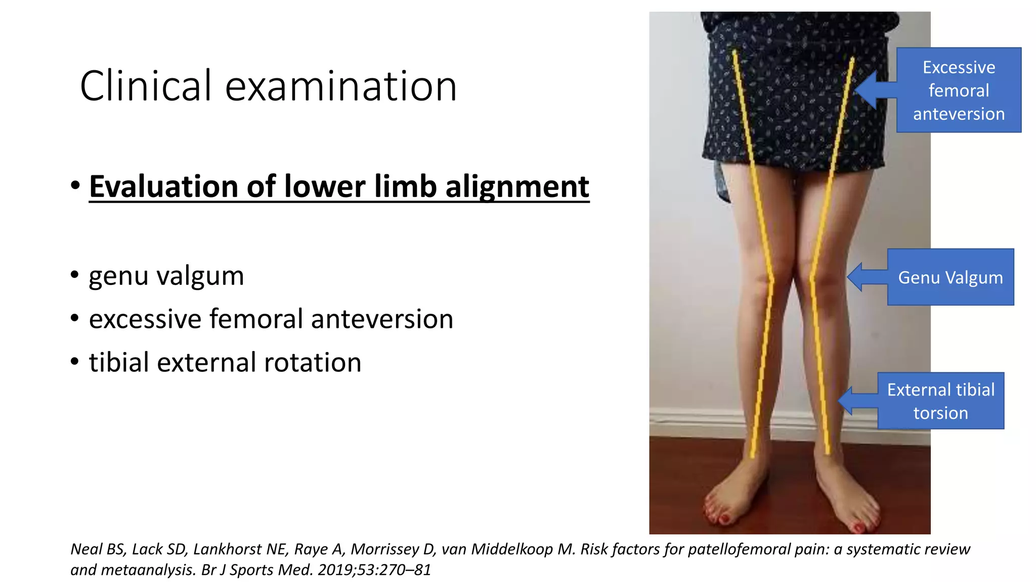 Approach to anterior knee pain.pptx